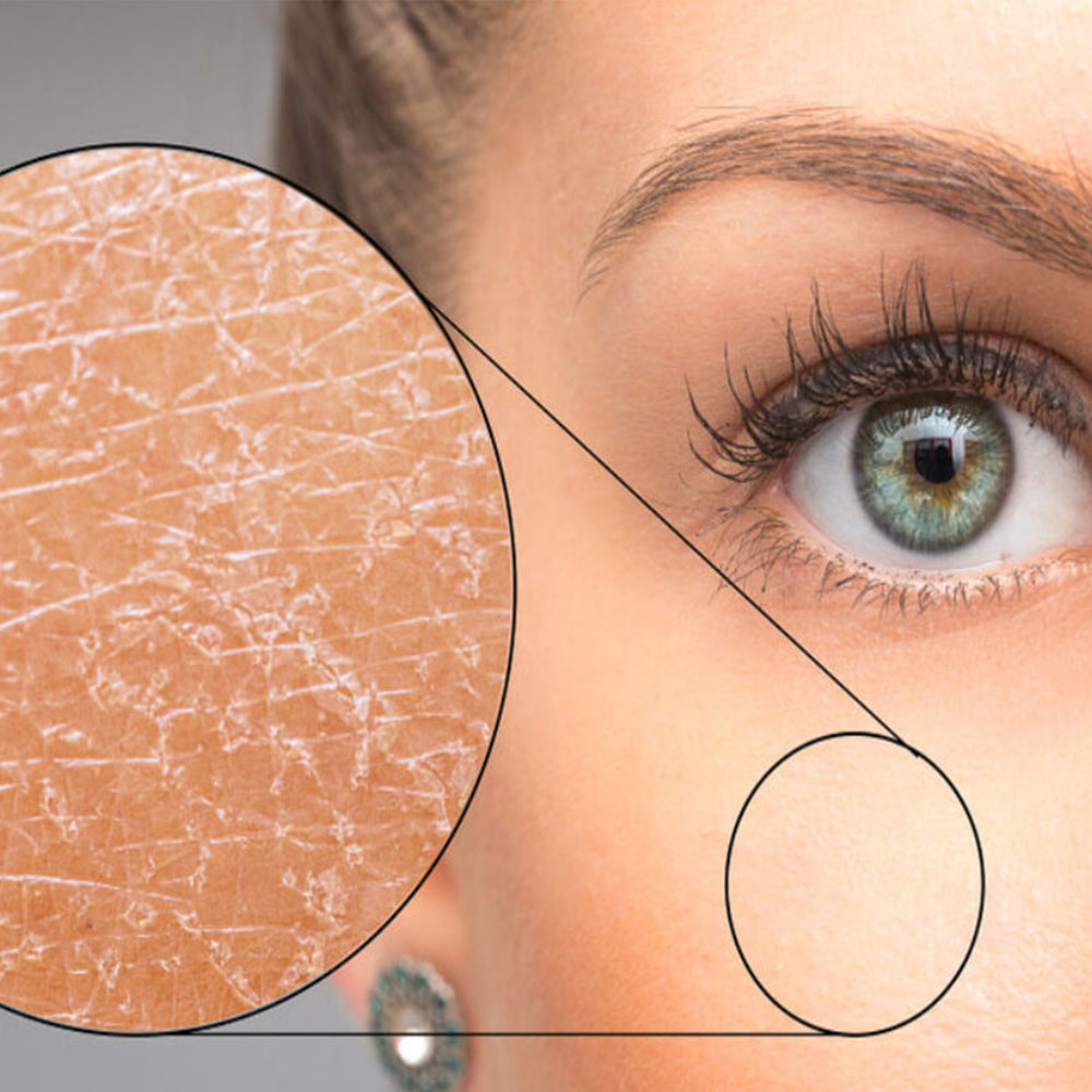 Dry Skin – Pevonia UK